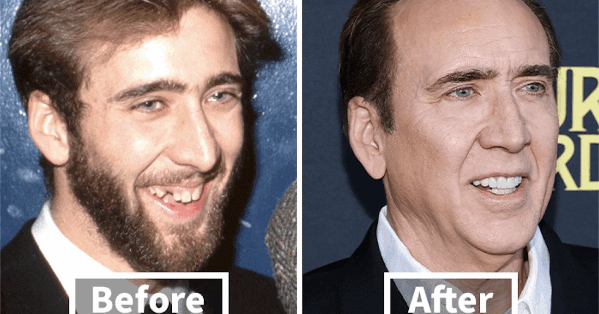 Transformations Unveiled: 14 Celebrities Before and After Their Dentist ...